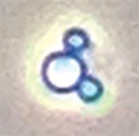 7: Routine Urinalysis–the Microscopic Exam of Urine Sediment