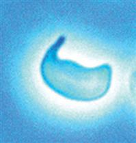 7: Routine Urinalysis–the Microscopic Exam of Urine Sediment