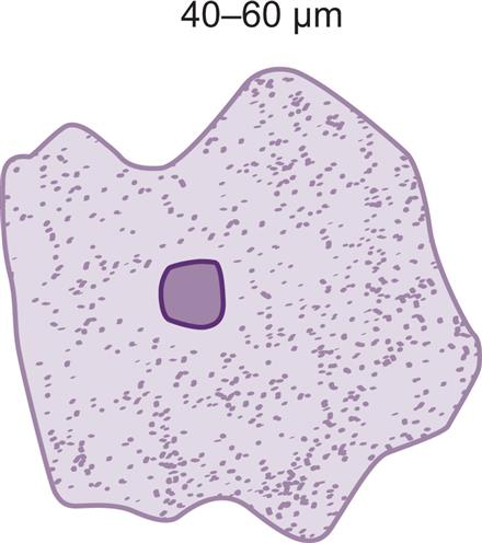 7: Routine Urinalysis–the Microscopic Exam of Urine Sediment