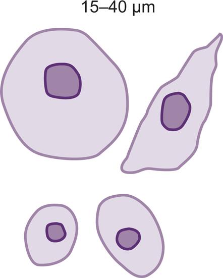 7: Routine Urinalysis–the Microscopic Exam of Urine Sediment