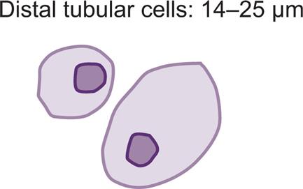 7: Routine Urinalysis–the Microscopic Exam of Urine Sediment