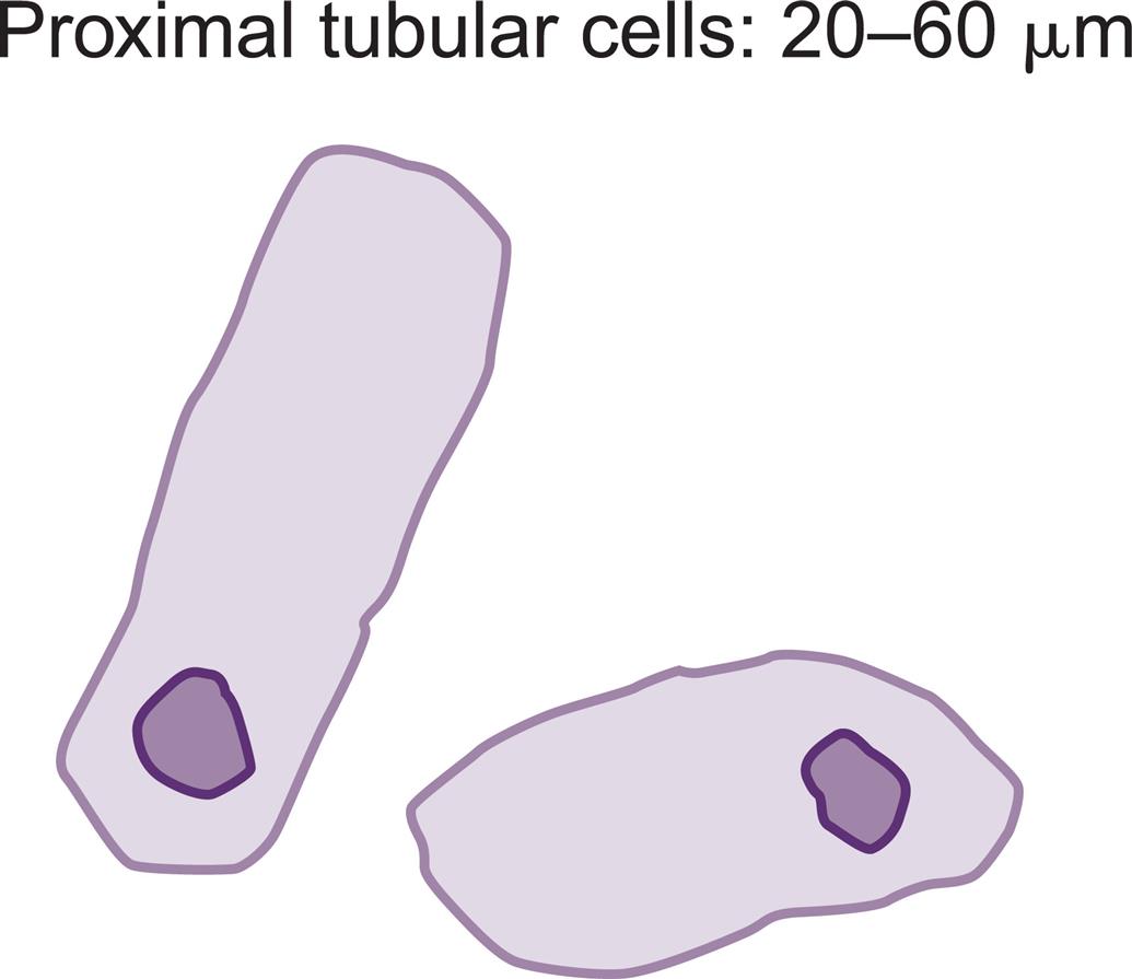 7: Routine Urinalysis–the Microscopic Exam of Urine Sediment