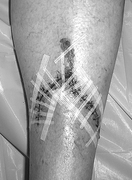 Minor Injuries: A Clinical Guide