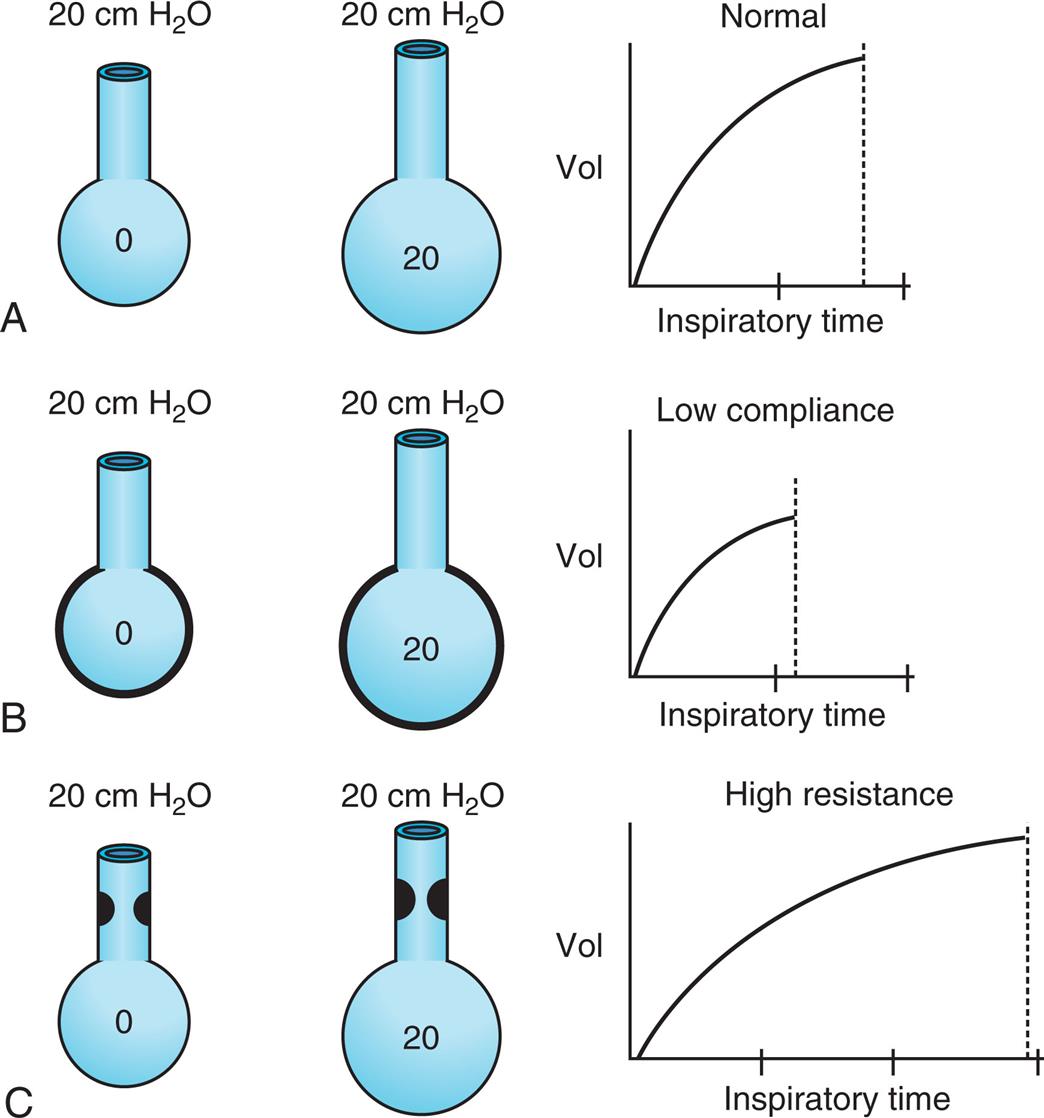 3: Mechanics of Ventilation