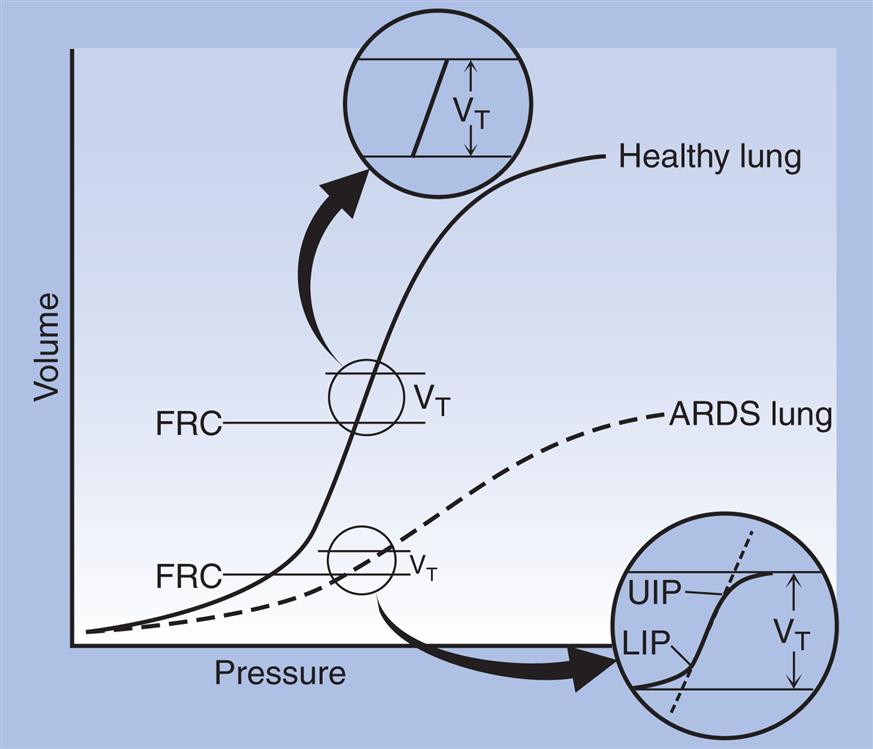 3: Mechanics of Ventilation