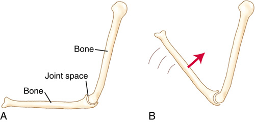 Classification of Joints