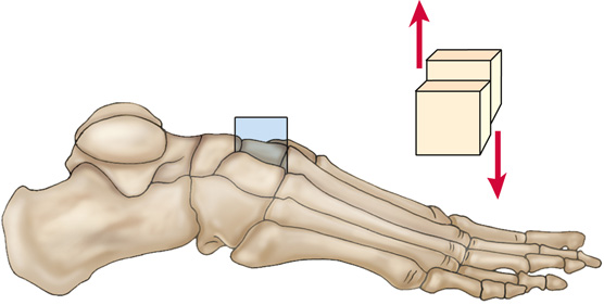 Classification of Joints