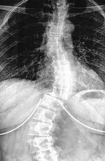 Types of Joint Motion and Musculoskeletal Assessment