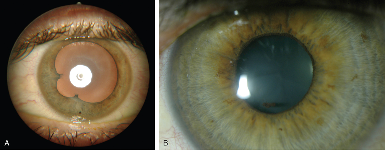 Clinical Anatomy and Physiology of the Visual System