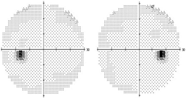 Clinical Anatomy and Physiology of the Visual System