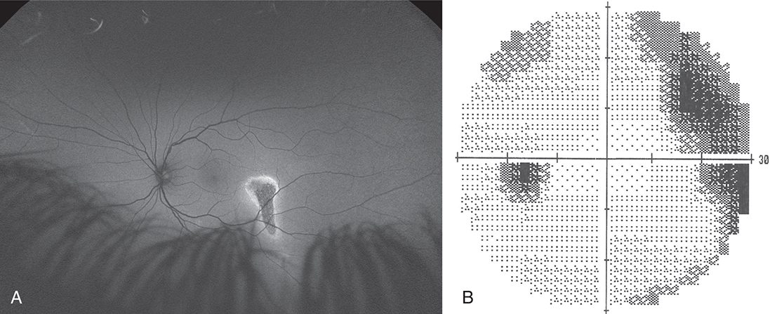 Clinical Anatomy and Physiology of the Visual System