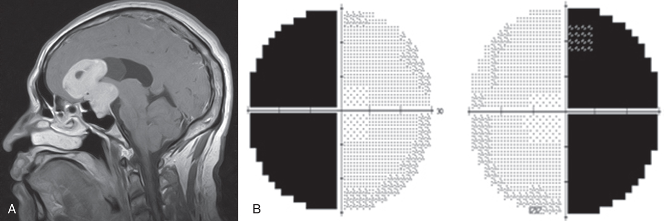 Clinical Anatomy and Physiology of the Visual System