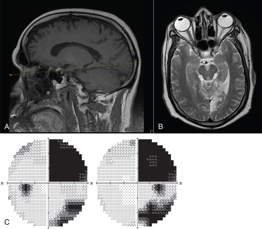 Clinical Anatomy and Physiology of the Visual System