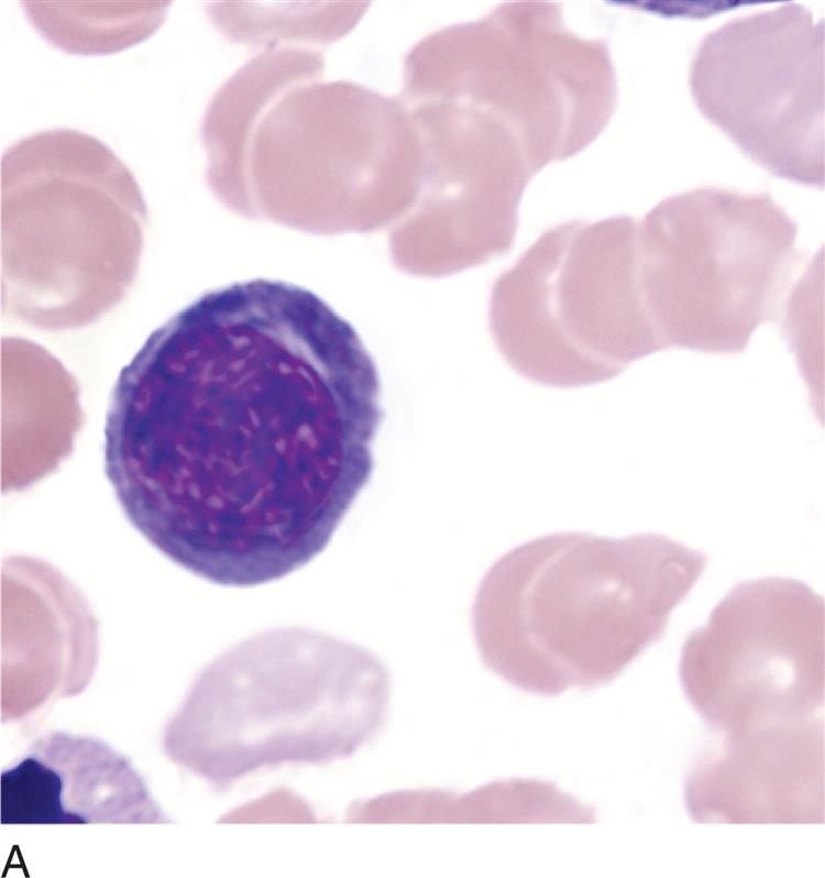 Clinical Hematology Atlas