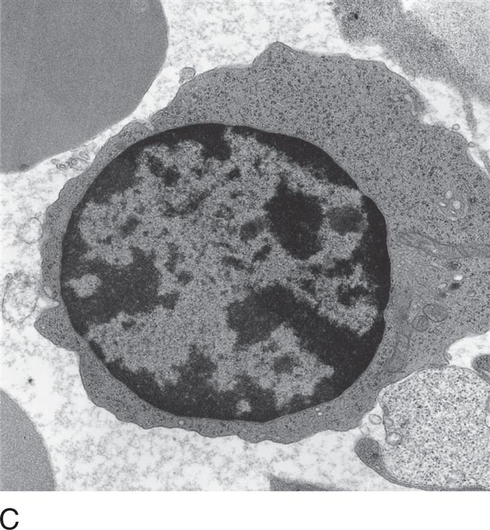 Clinical Hematology Atlas
