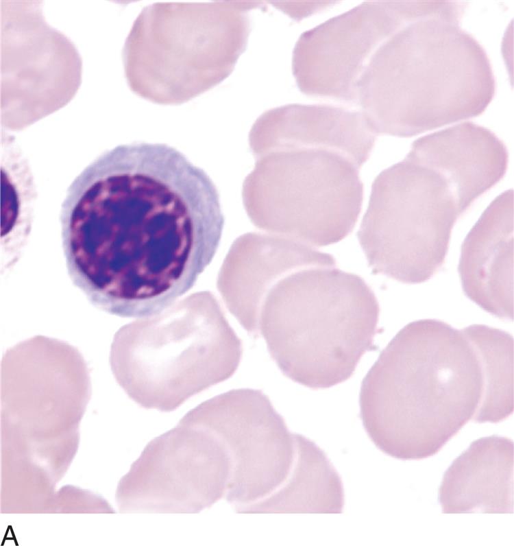 Clinical Hematology Atlas