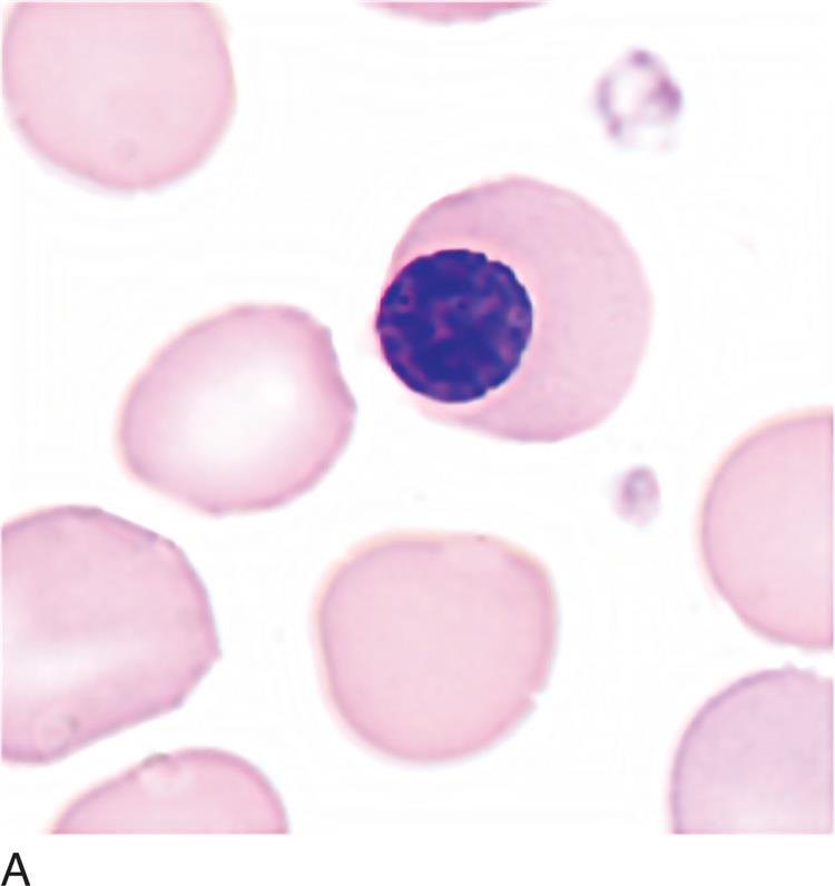 Clinical Hematology Atlas