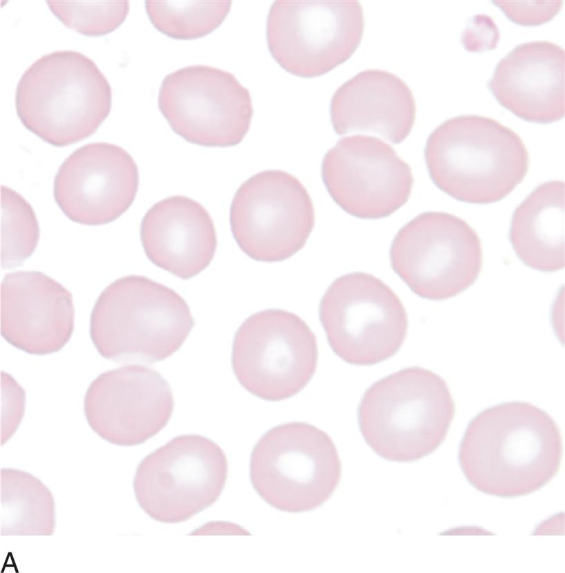 Clinical Hematology Atlas