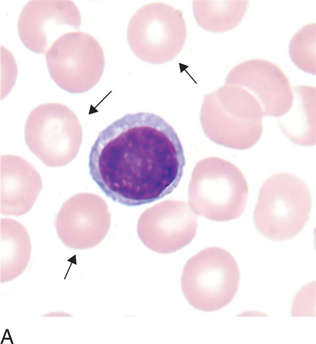 Clinical Hematology Atlas