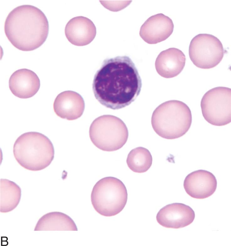 Clinical Hematology Atlas