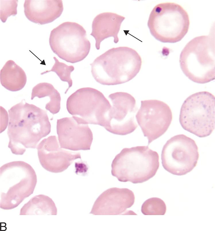 Clinical Hematology Atlas