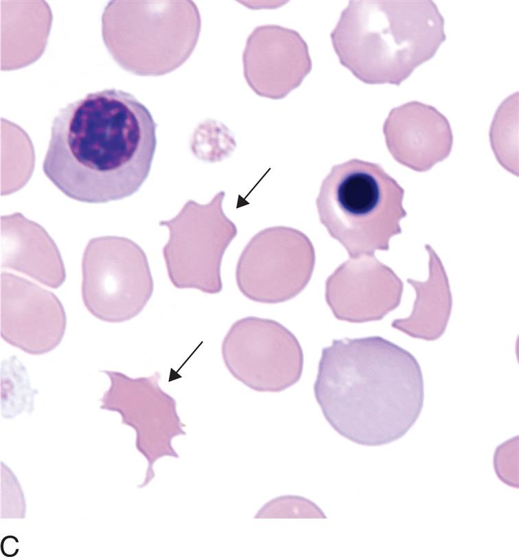 Clinical Hematology Atlas