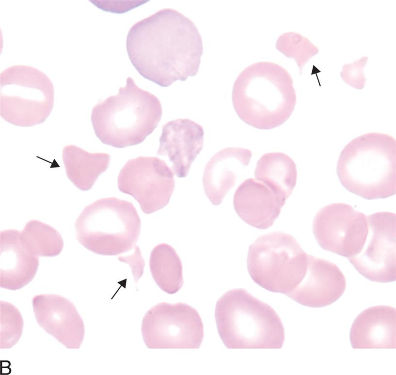 Clinical Hematology Atlas