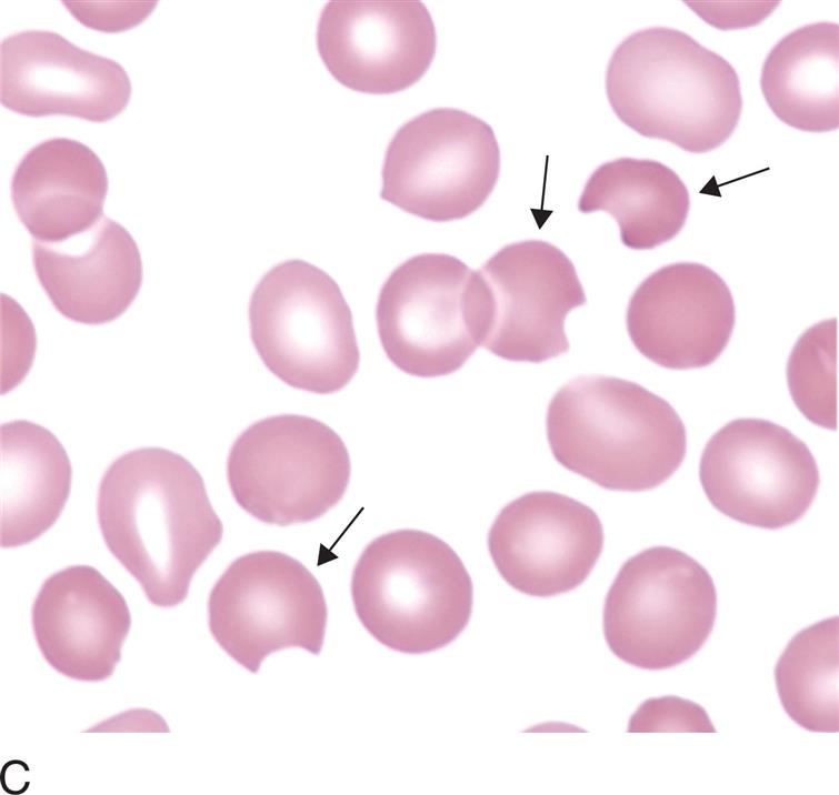 Clinical Hematology Atlas