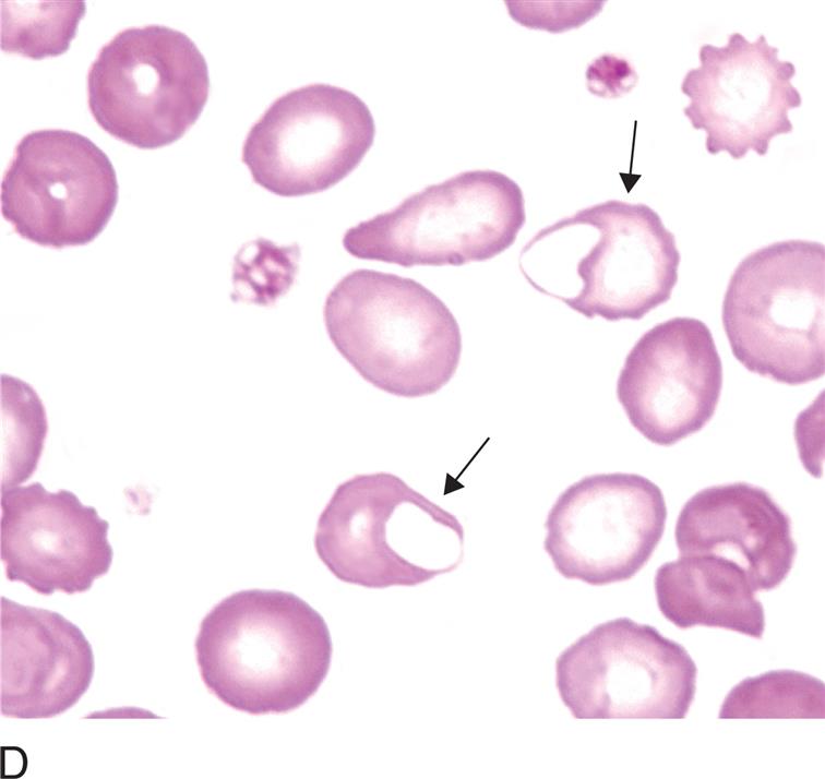 Clinical Hematology Atlas