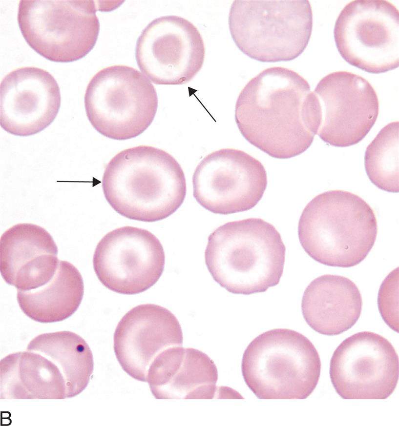 Clinical Hematology Atlas