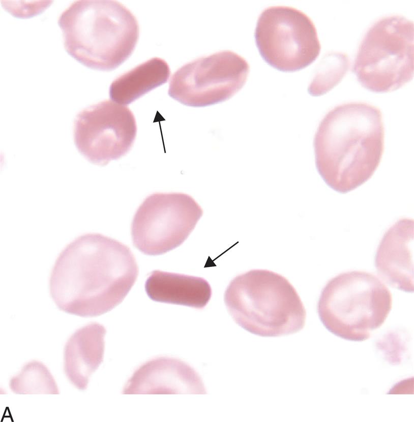 Clinical Hematology Atlas