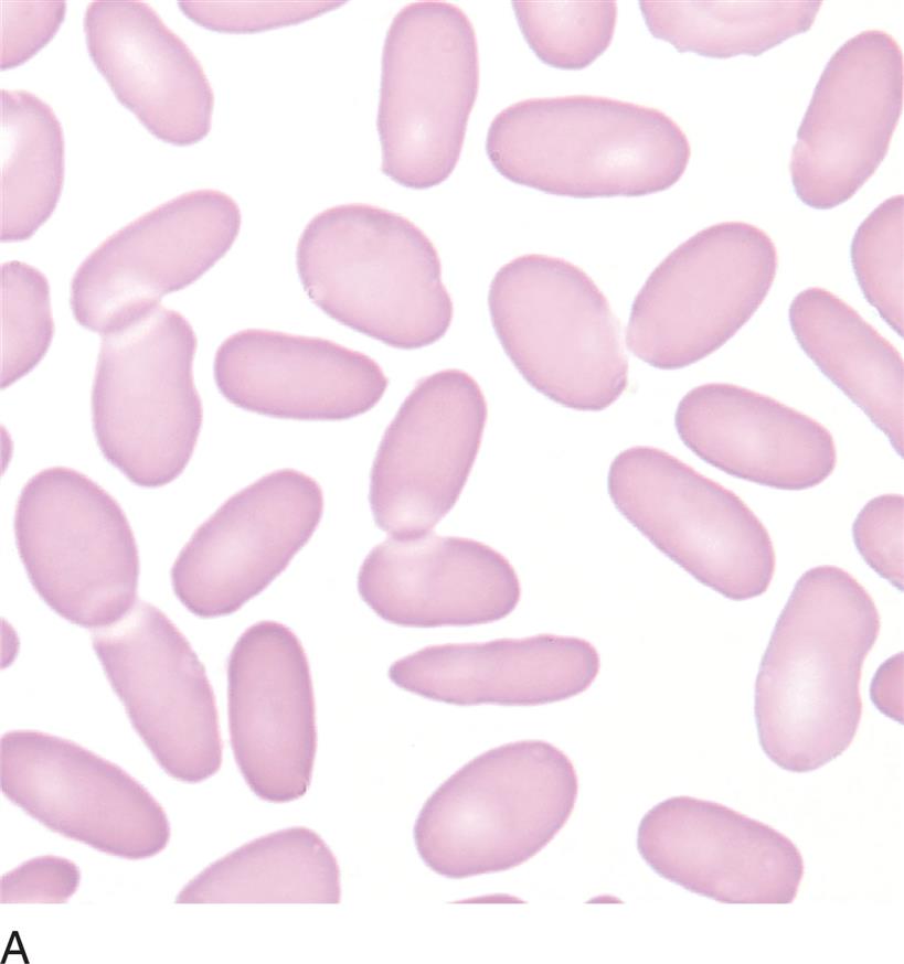 Clinical Hematology Atlas