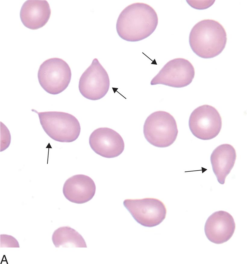 Clinical Hematology Atlas