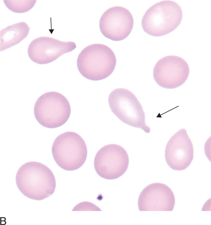 Clinical Hematology Atlas