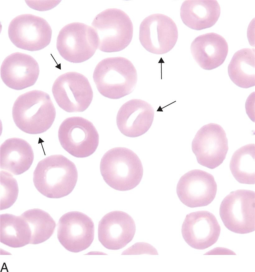 Clinical Hematology Atlas