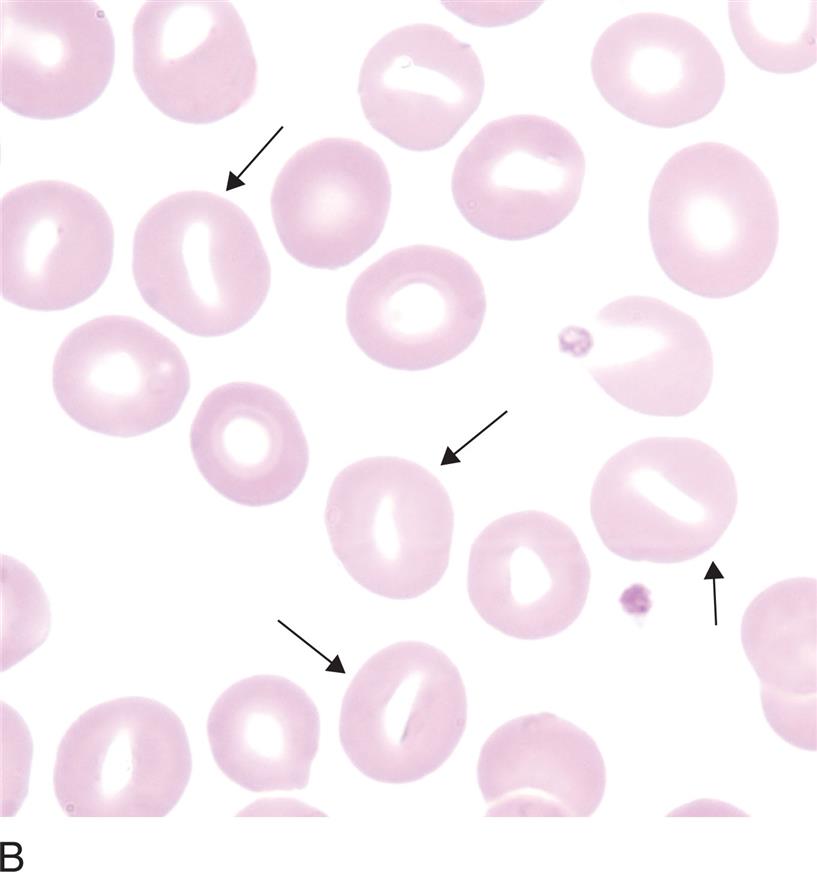 Clinical Hematology Atlas