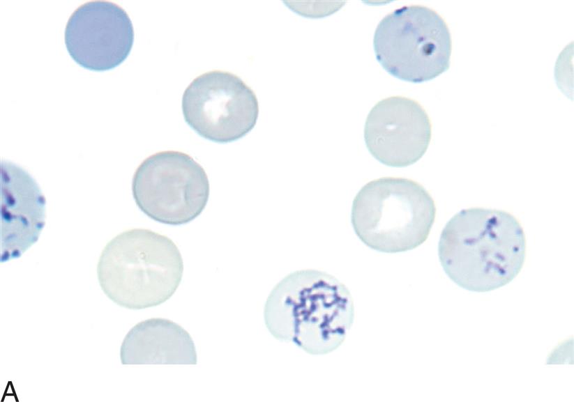 Clinical Hematology Atlas