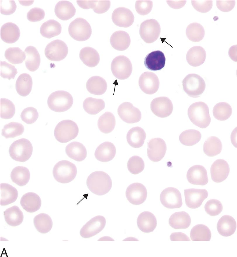 Clinical Hematology Atlas