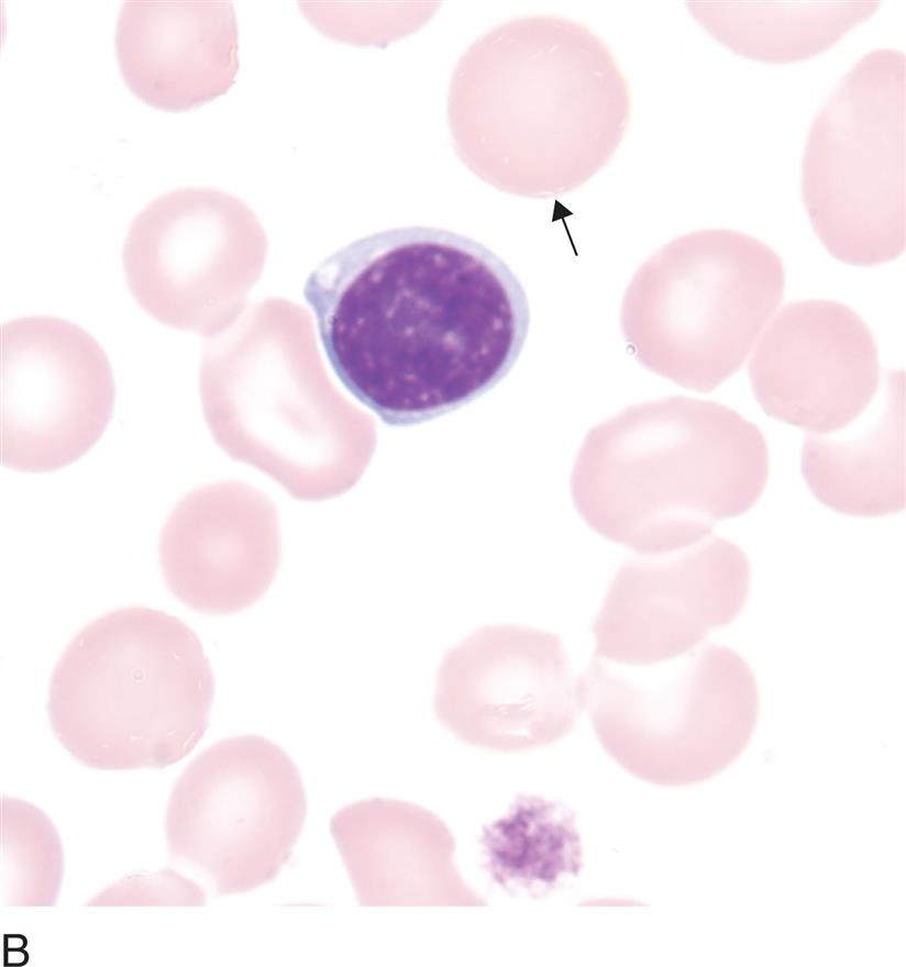 Clinical Hematology Atlas