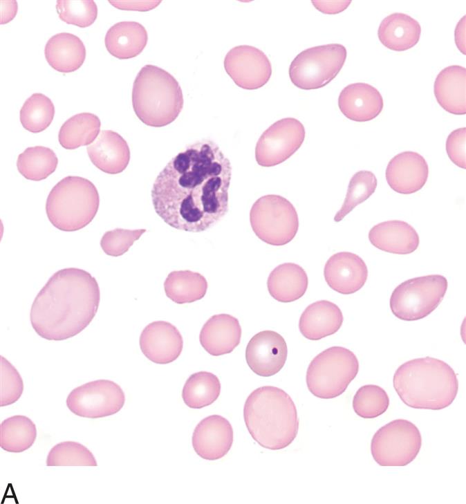 Clinical Hematology Atlas