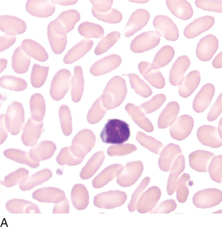 Clinical Hematology Atlas