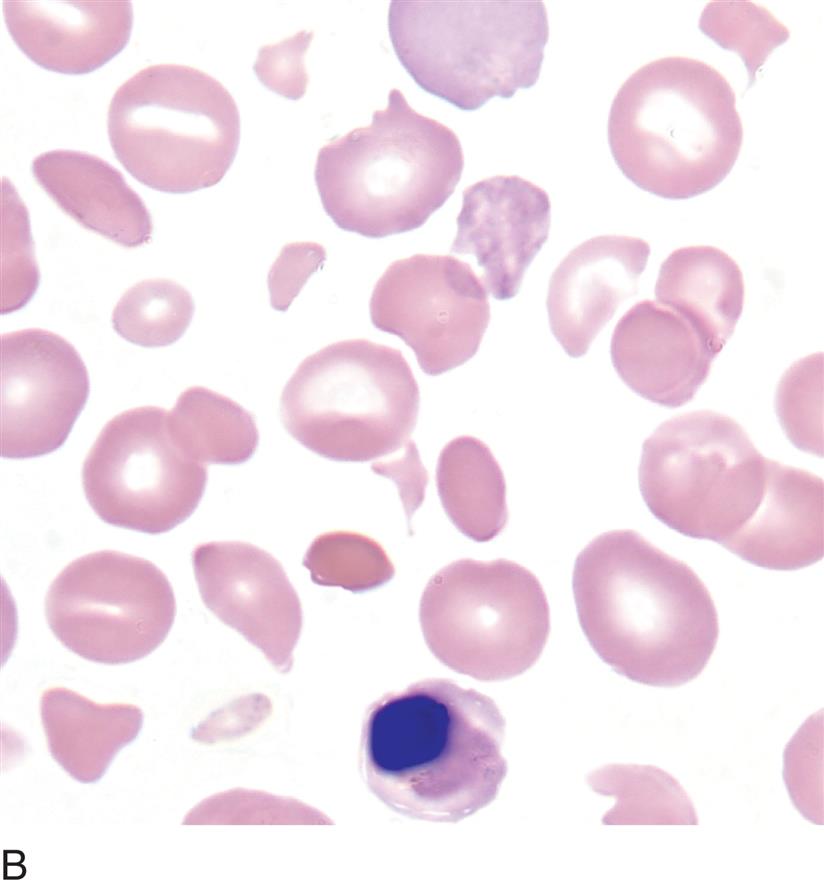 Clinical Hematology Atlas