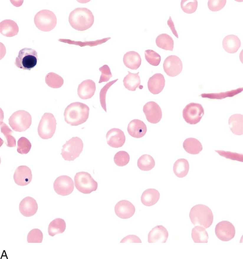 Clinical Hematology Atlas