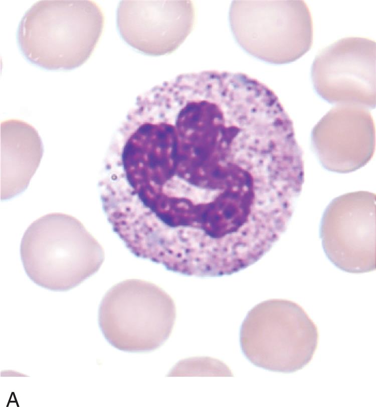 Clinical Hematology Atlas