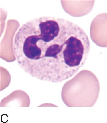 Clinical Hematology Atlas