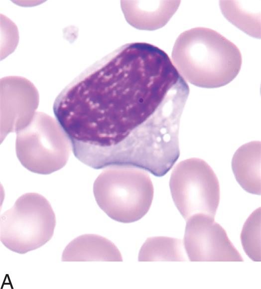 Clinical Hematology Atlas