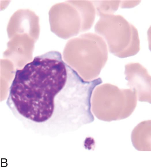 Clinical Hematology Atlas