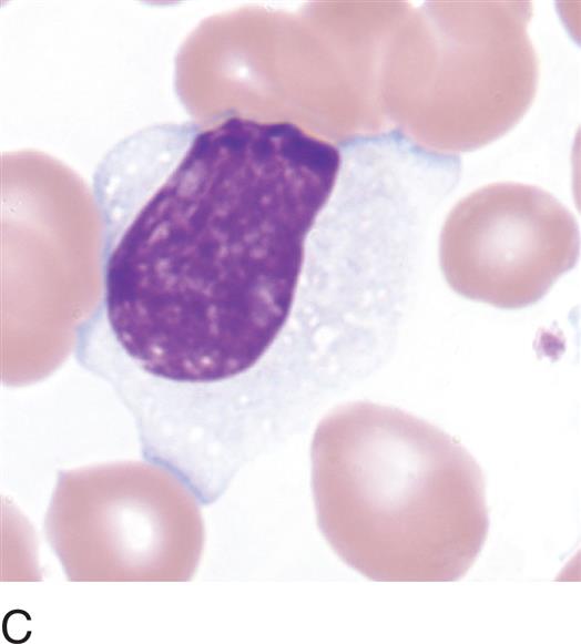 Clinical Hematology Atlas