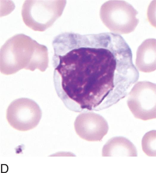 Clinical Hematology Atlas
