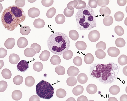 Rodak's Hematology Clinical Principles and Applications